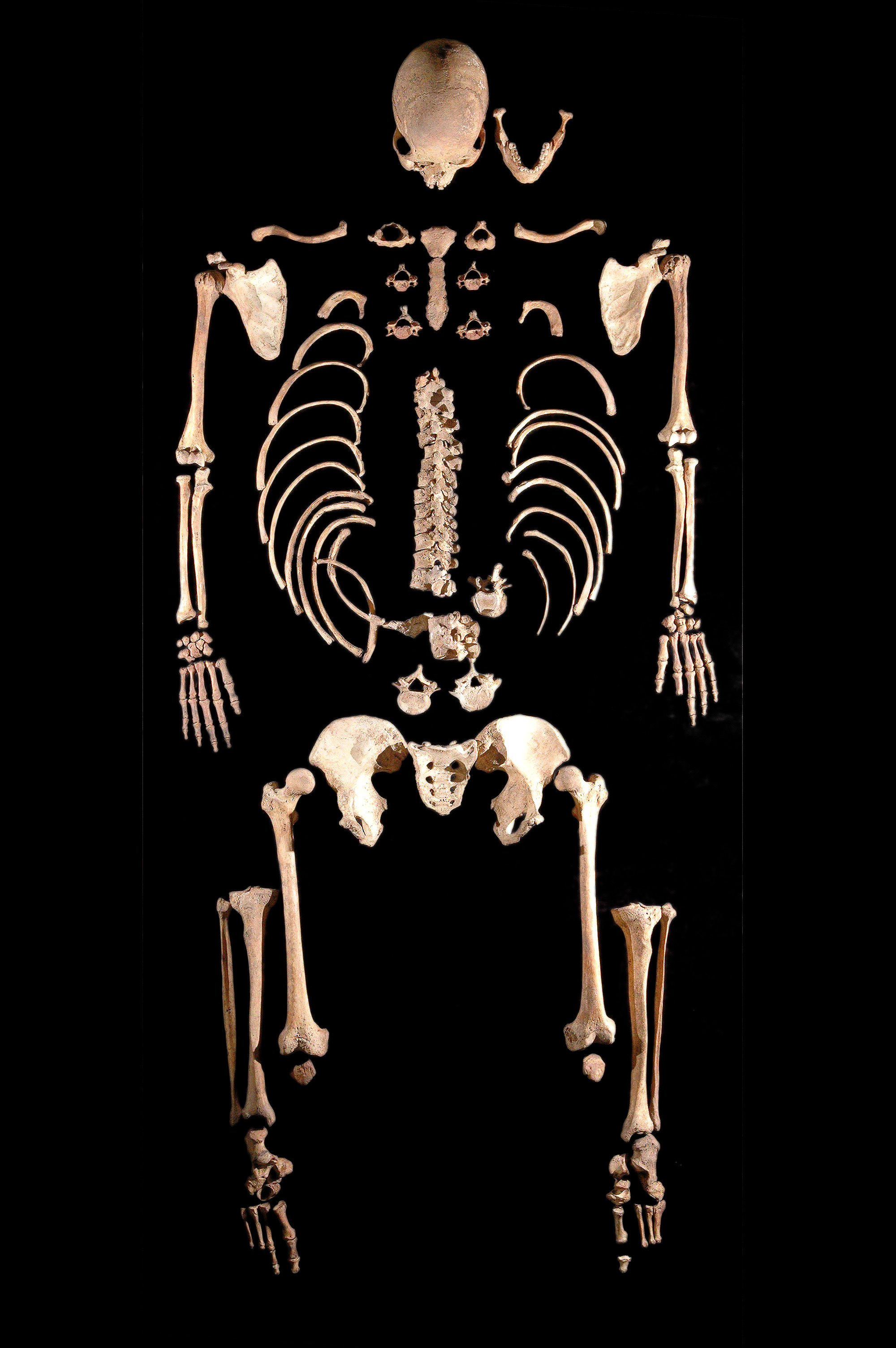 Old blue eyes: What ancient DNA reveals about a 7,000-year-old hunter ...